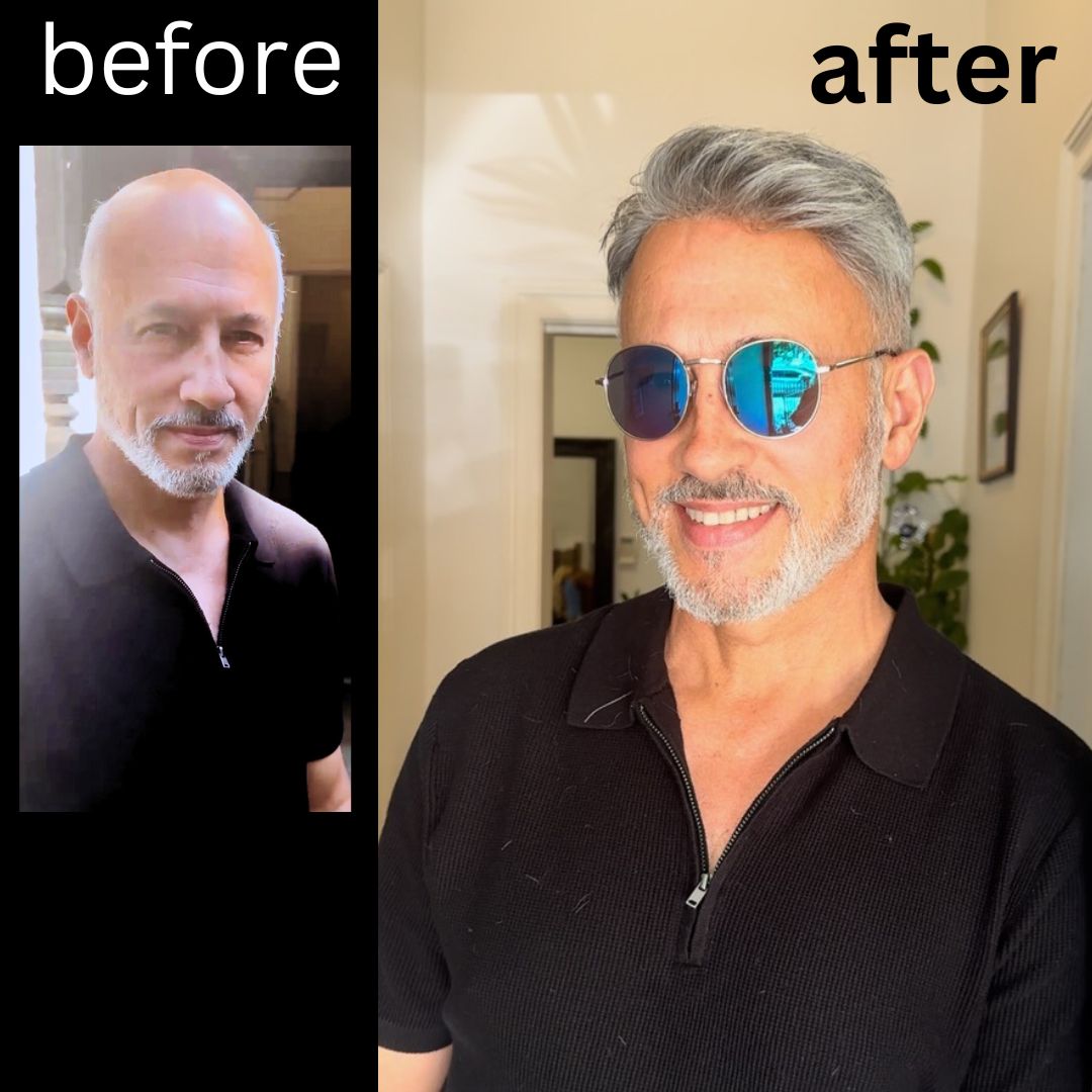 Mens Hair Systems - The Australian Wig Company